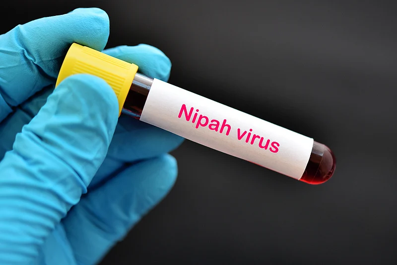 Asian airports on alert after Nipah virus cases in India - Plataforma Media